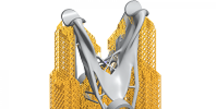 ESI ProCAST 2021.5 Suite Free Download